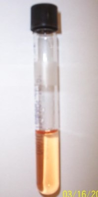 Helicobacter Pylori Urease Culture - BCHS