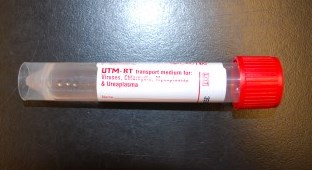 Chlamydia Culture - BCHS