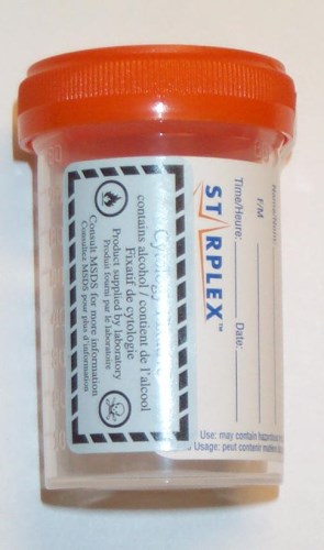 Lymph Node Fine Needle Aspirate - BCHS